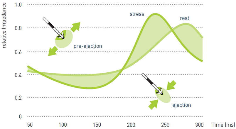 Biotronik | Rate Responsive Programming